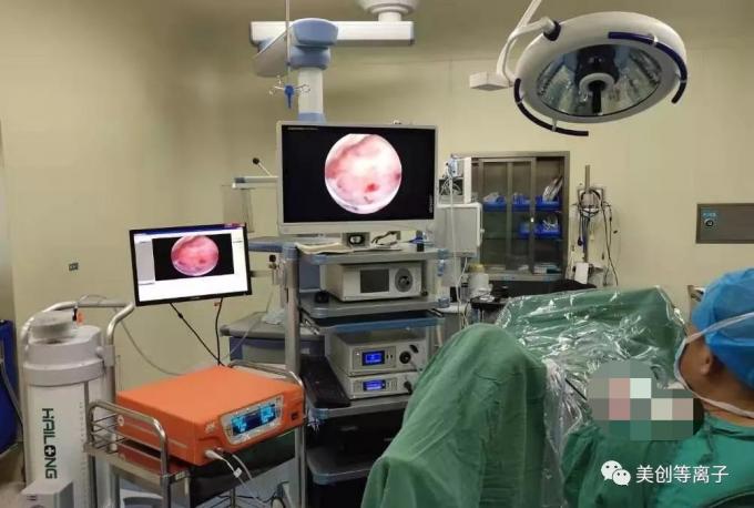 Desktop Prostate Urology Rf Ablation Devices Kinetic Plasma Surgery BPH
