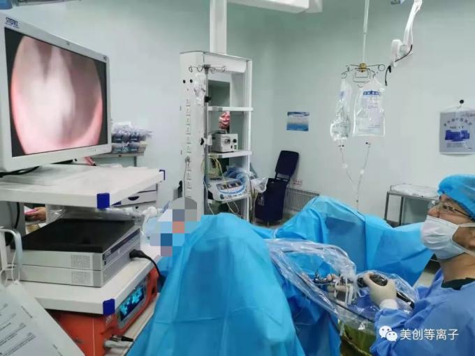 Bipolar Plasma Surgery BPH Surgery Probe Plasma Prostate Enucleation ...