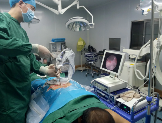 Bipolar Electrosurgical Unit Plasma Electrode Coblator System Spine ...