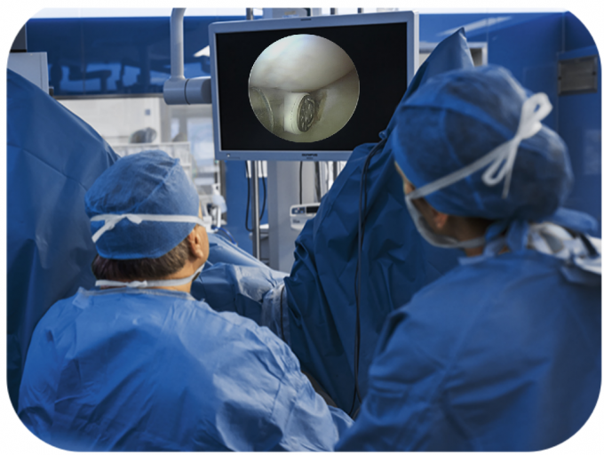 Orthopedic surgery instruments radio frequency plasma generator console ...