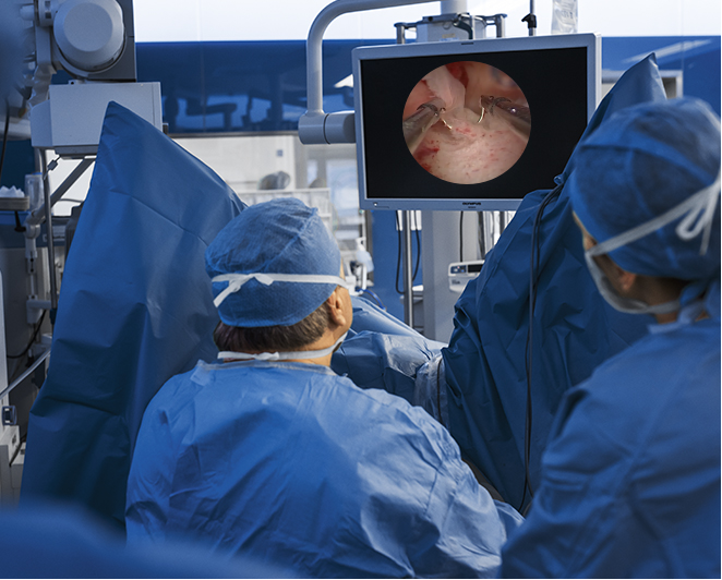 Gynecology Hysteroscopy supporting equipment for endometrial polyps ...